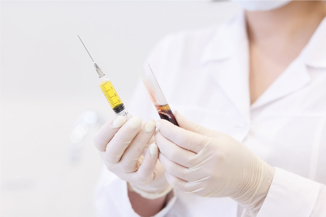 prp-plasma-fillers-overview | Eterna MD